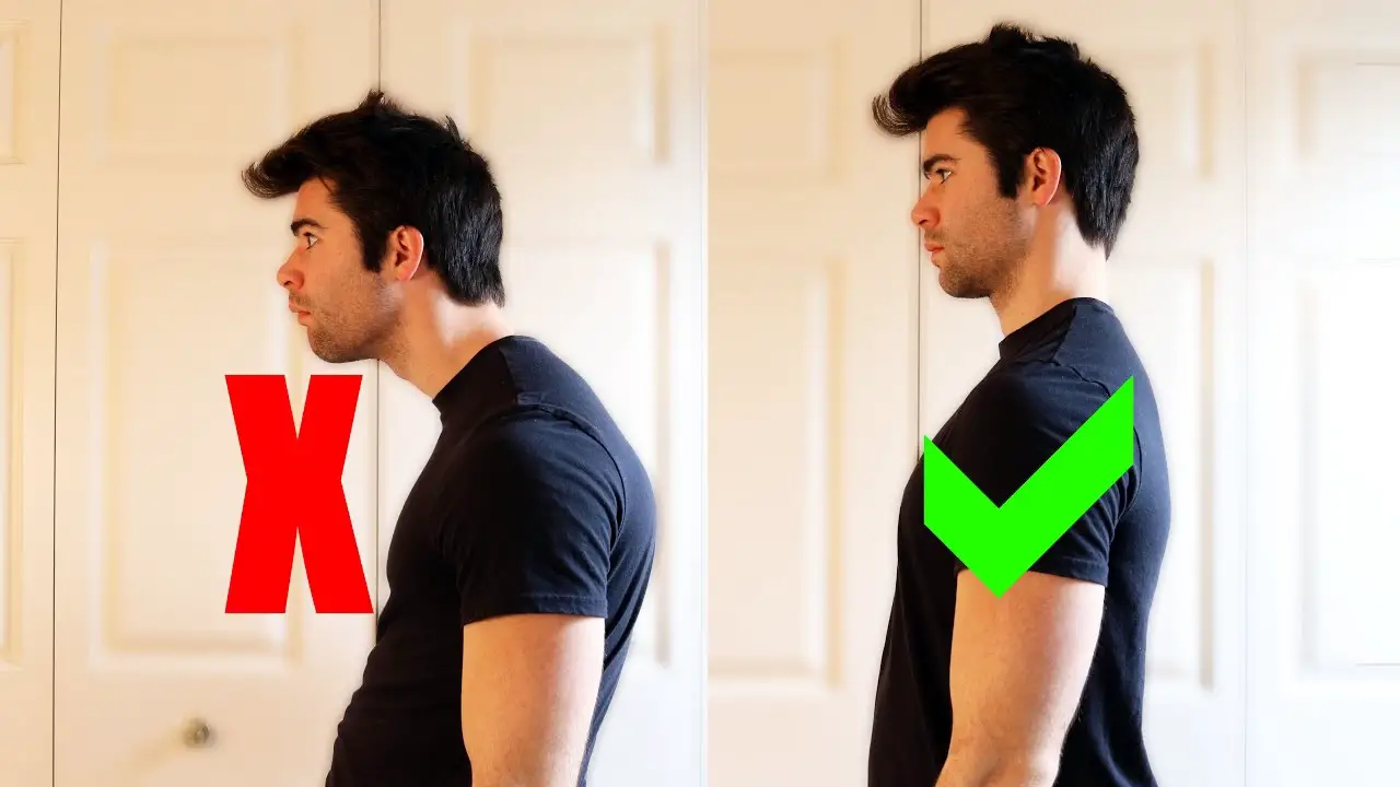 How to Fix Nerd Neck - Video Games, Wikis, Cheats, Walkthroughs ... How to Fix Nerd Neck - Video Games, Wikis, Cheats, Walkthroughs ...